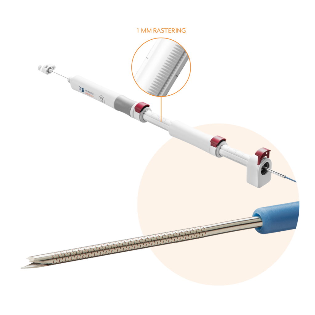 EBUS Needles - MICRO-TECH EUROPE